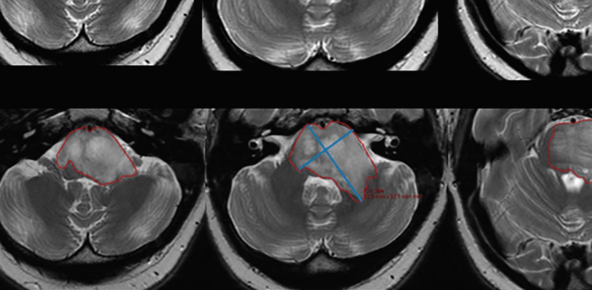 Cincinnati Children's Hospital Medical Center: Study shows variable ...