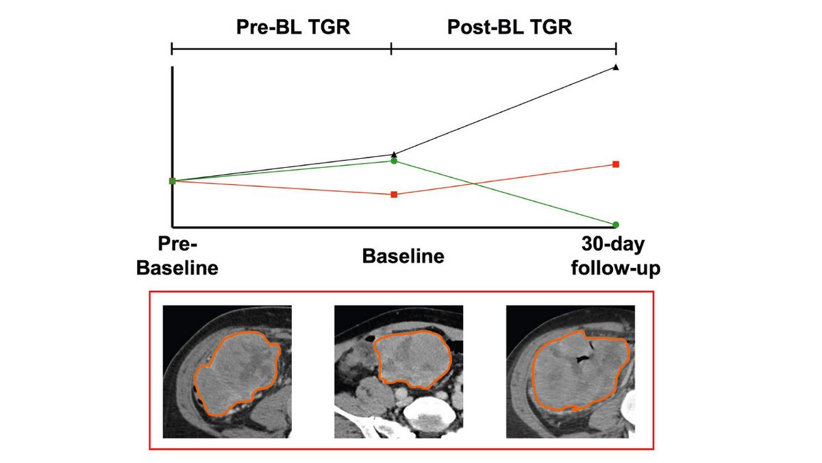 University Hospital Munich (LMU): Study Analyzing the Tumor Growth Rate ...